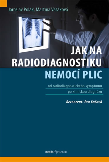 Jak na radiodiagnostiku nemocí plic | SEVT.cz